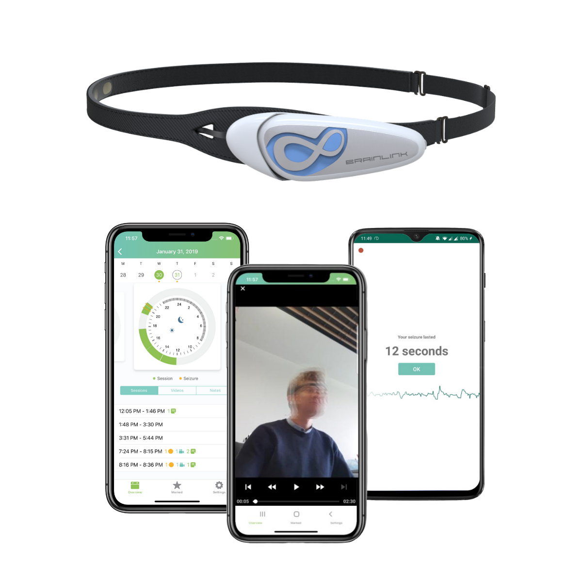 Worldwide first absence seizure tracker becomes available to Australian ...